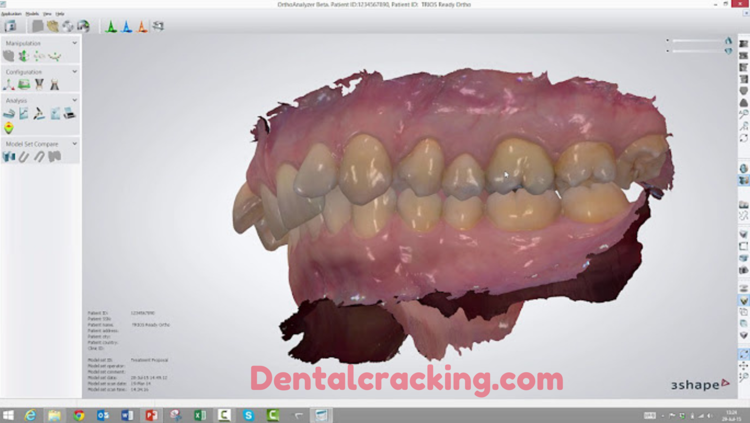 3Shape Ortho System 2023 Crack Download - Orthodontic