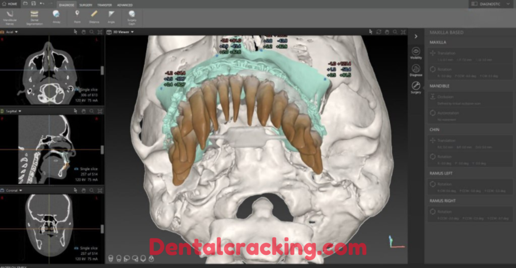 IPS Case Designer 2.5.7.1 Crack (2024) Download - Surgery