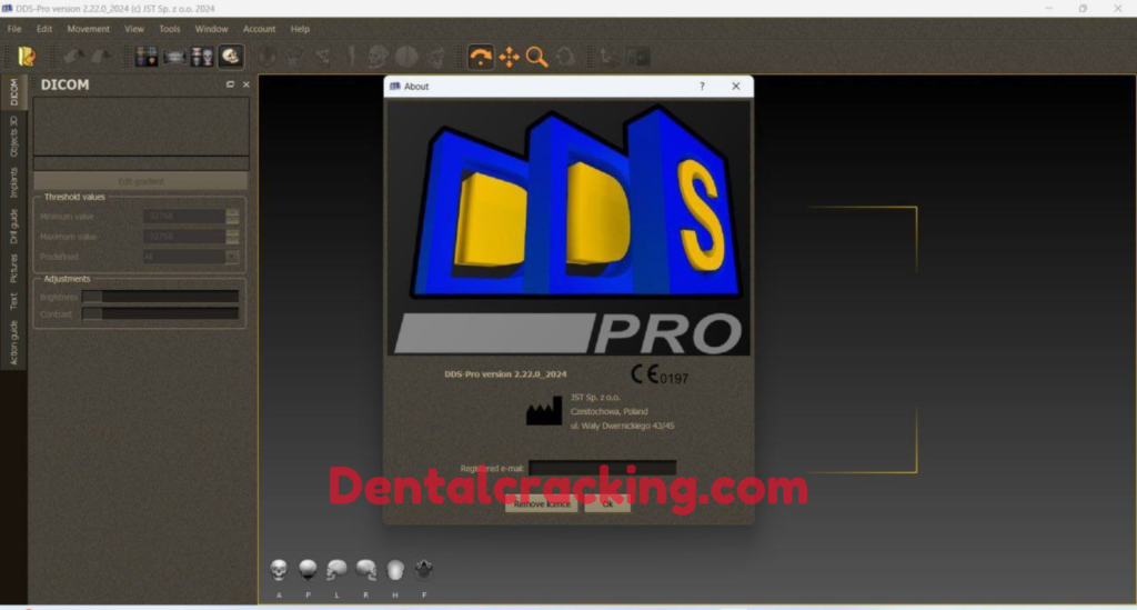 DDS Pro 2024 Crack: Advanced Dental Implant Planning & Guide Design